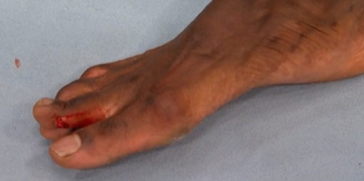 UFC 175: Weidman vs. Machida Post-Fight – Evolutionary.org